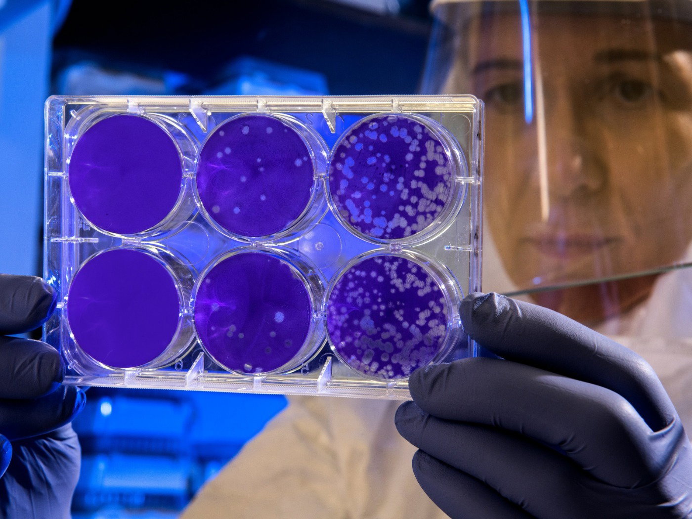 O que é Bioética: princípios, resumo e exemplos - Significados